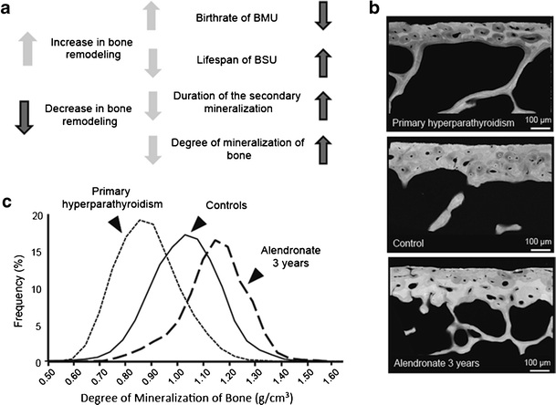 Bone mineralization: from tissue to crystal in normal and pathological ...