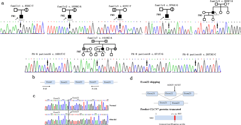 Novel mutations of CLCN7 cause autosomal dominant osteopetrosis type II ...