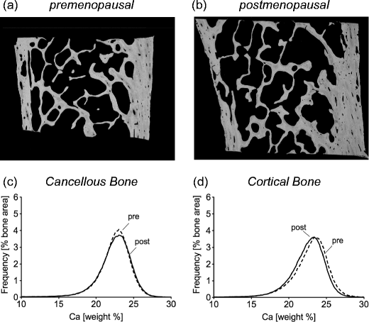 Bone matrix mineralization is preserved during early perimenopausal ...