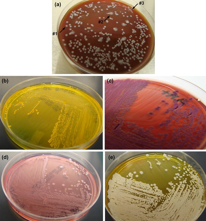Characterization of in vitro phenotypes of Burkholderia pseudomallei ...