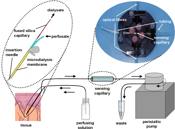 Microdialysis-based sensing in clinical applications | SpringerLink