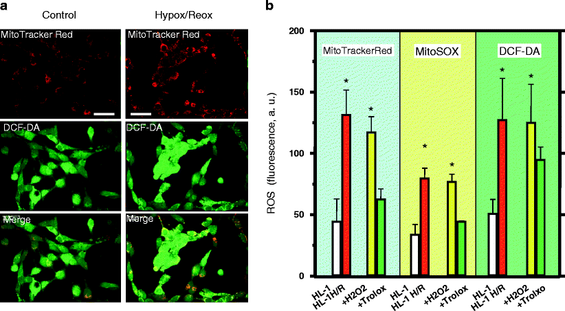 Mitochondrial ROS production under cellular stress: comparison of ...