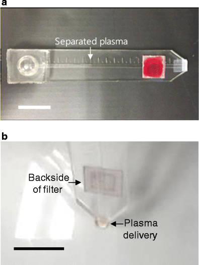 A smart pipette for equipment-free separation and delivery of plasma ...