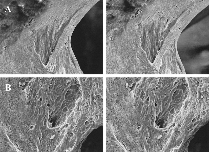 Microstructural Classification of Resorption Lacunae and Perforations ...