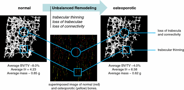Bone Volume Fraction Explains the Variation in Strength and Stiffness ...