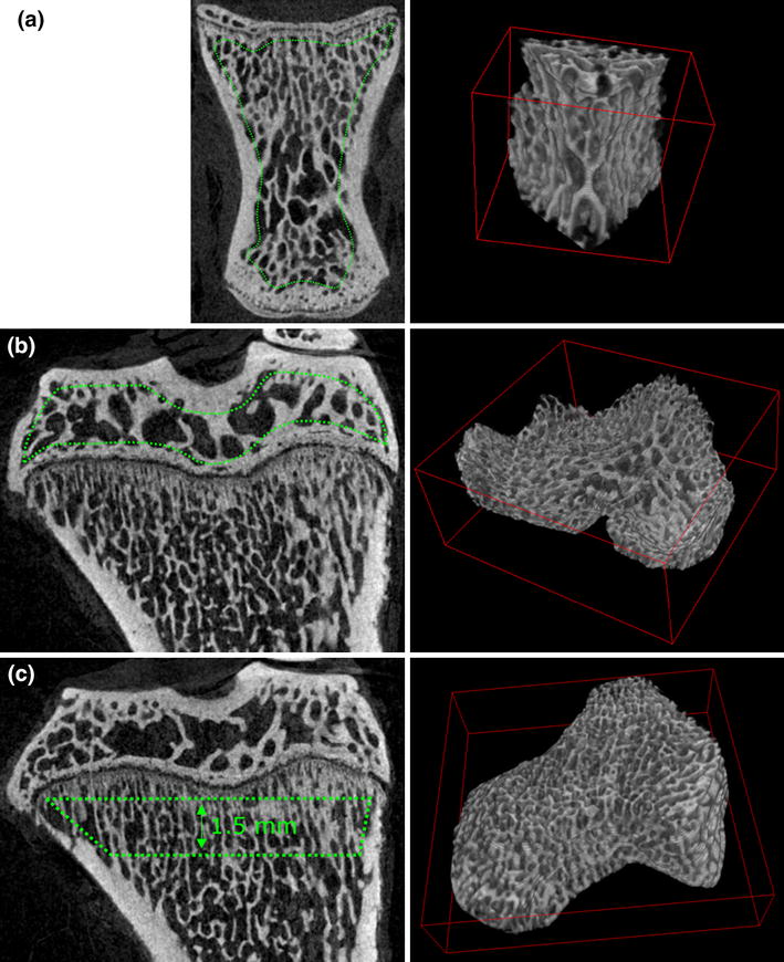 Characterising Bone Material Composition and Structure in the ...