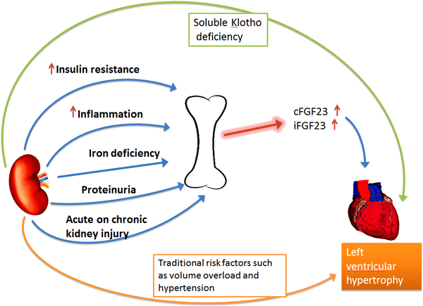 Novel Faces of Fibroblast Growth Factor 23 (FGF23): Iron Deficiency ...