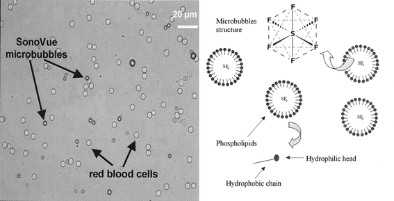 The Effect of Contrast Medium SonoVue® on the Electric Charge Density ...