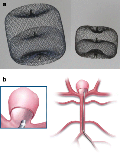 The Woven EndoBridge Cerebral Aneurysm Embolization Device (WEB II ...