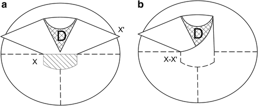 Triple-V flap: nipple reconstruction using a modified C-V flap ...