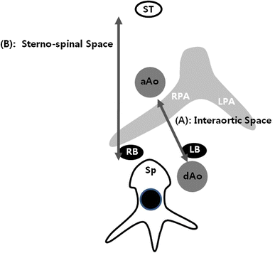Outcomes of Aortopexy for Patients With Congenital Heart Disease ...