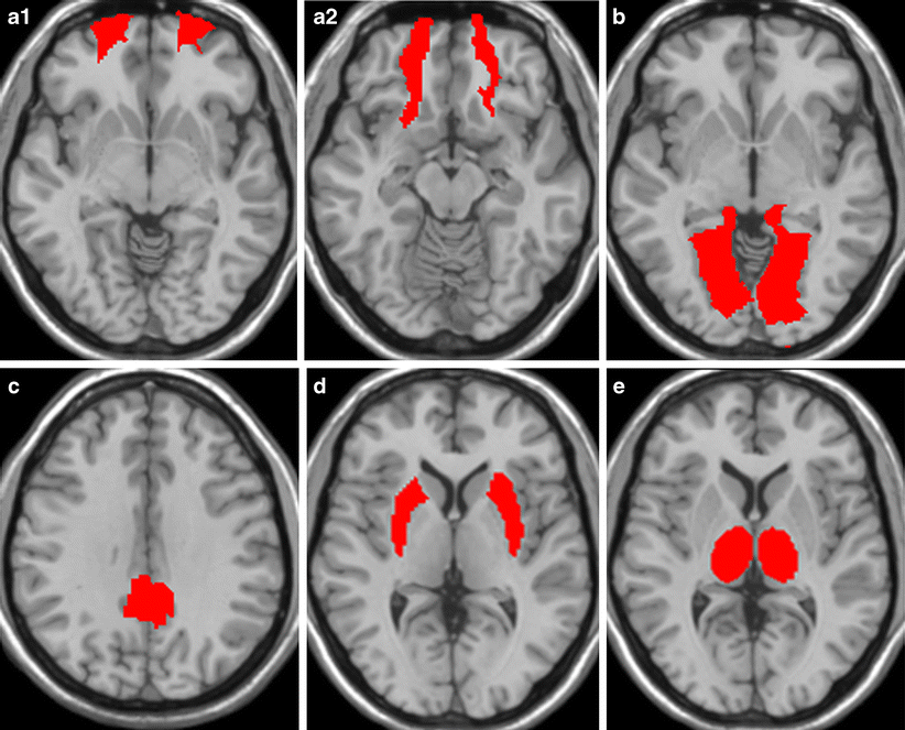 Periventricular leukomalacia in preterm children: assessment of grey ...