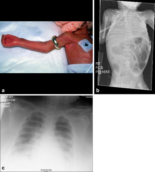 Image Gently: Challenges for radiologic technologists when performing ...