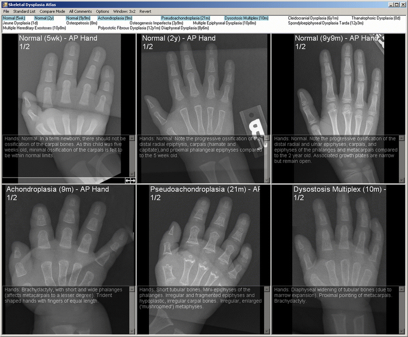 Interactive digital atlas of skeletal surveys for common skeletal ...