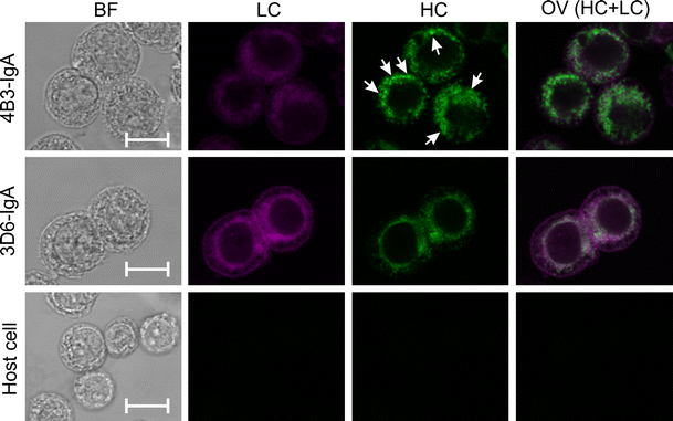 In search of expression bottlenecks in recombinant CHO cell lines—a ...