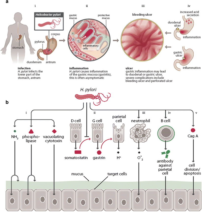 Biomarkers and diagnostic tools for detection of Helicobacter pylori ...