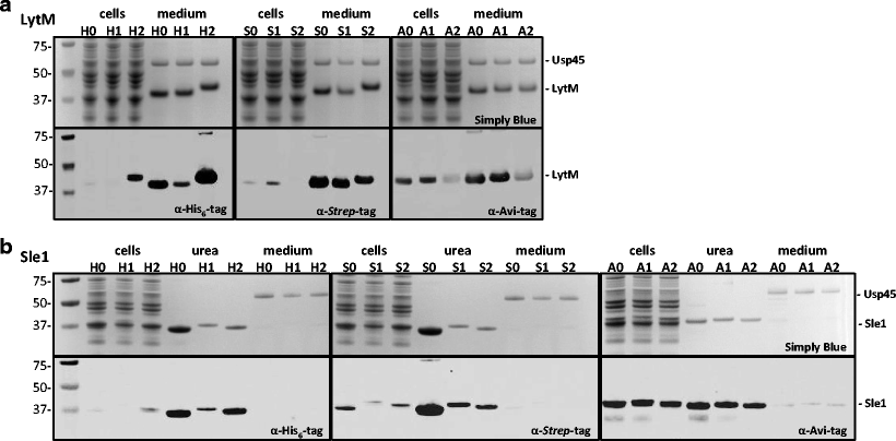 A Lactococcus lactis expression vector set with multiple affinity tags ...