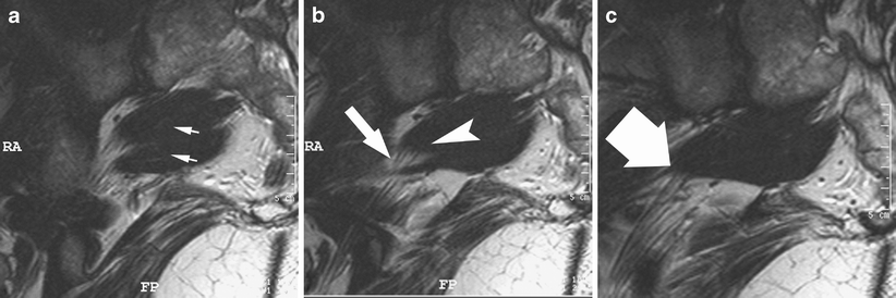 Surgical evaluation of magnetic resonance imaging findings in ...