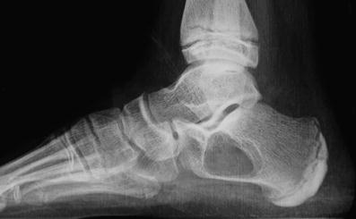 Do we really need radiographic assessment for the diagnosis of non ...