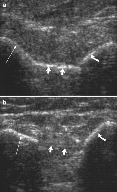 The role of ultrasound and magnetic resonance imaging in the evaluation ...