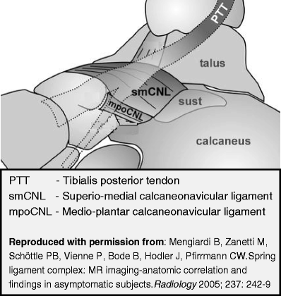 MRI features most often associated with surgically proven tears of the ...