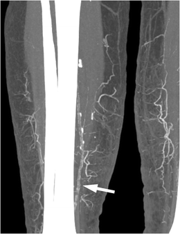 A case report: radiological findings in an unusual case of ...