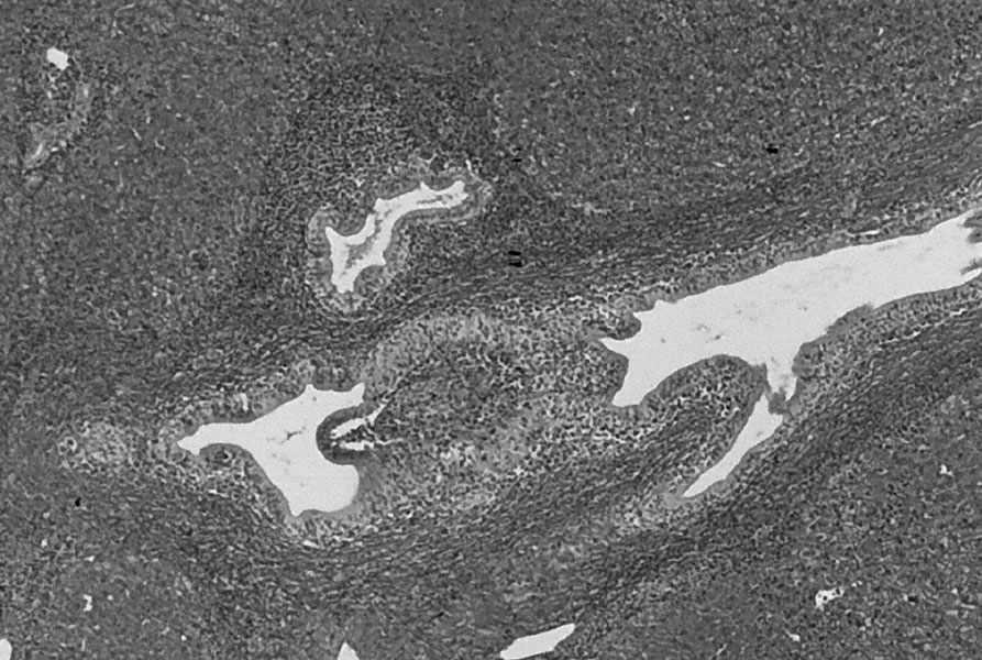 MRI findings of primary biliary cirrhosis: correlation with Scheuer ...