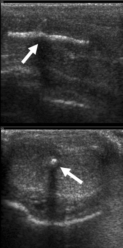Erectile dysfunction: the role of penile Doppler ultrasound in ...