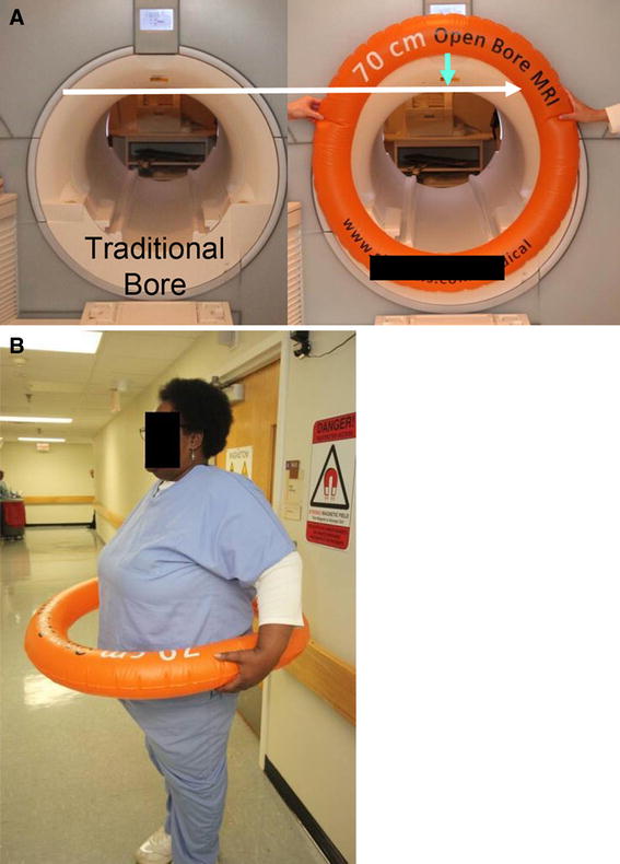 Imaging obese patients: problems and solutions | SpringerLink