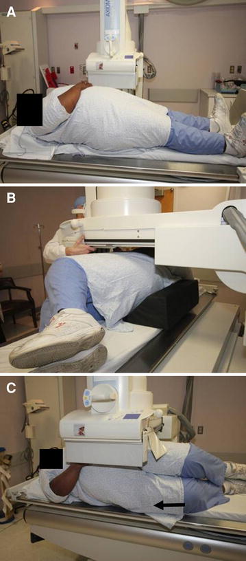 Imaging obese patients: problems and solutions | SpringerLink