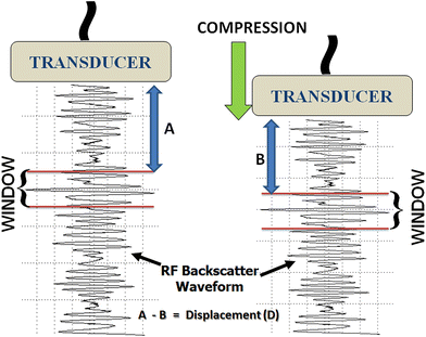 Elastography: history, principles, and technique comparison | SpringerLink