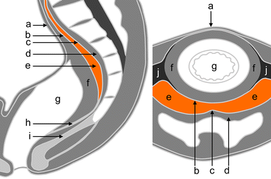 MR imaging of the retrorectal–presacral tumors: an algorithmic approach ...