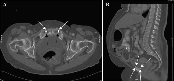 Cross-sectional imaging following surgical interventions for stress ...