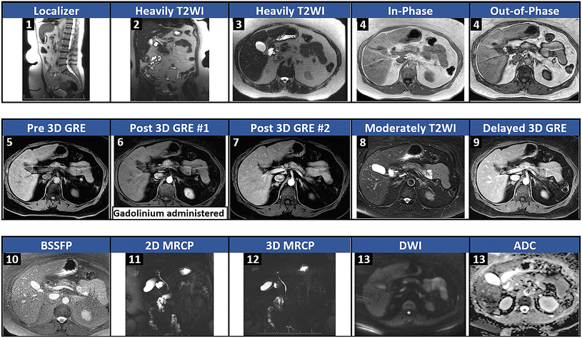 Interpreting body MRI cases: what you need to know to get started ...