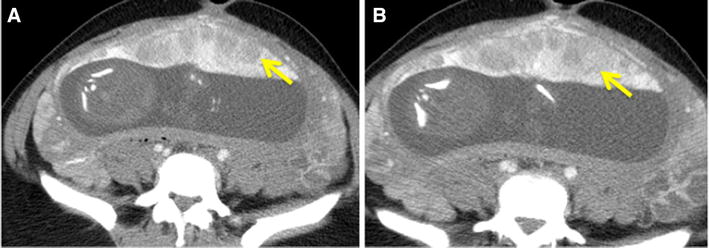 Trauma in pregnant women: assessing detection of post-traumatic ...