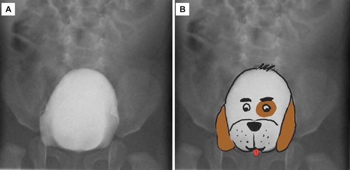 The “Bladder ear” | SpringerLink