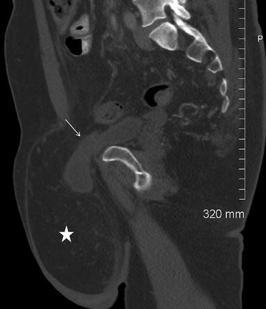 The “Bladder ear” | SpringerLink