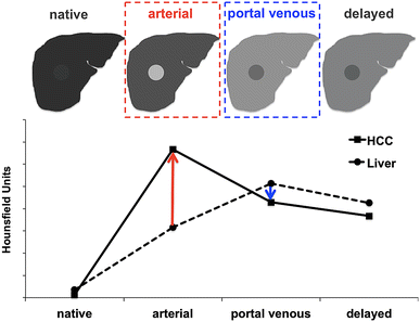 Iodine material density images in dual-energy CT: quantification of ...