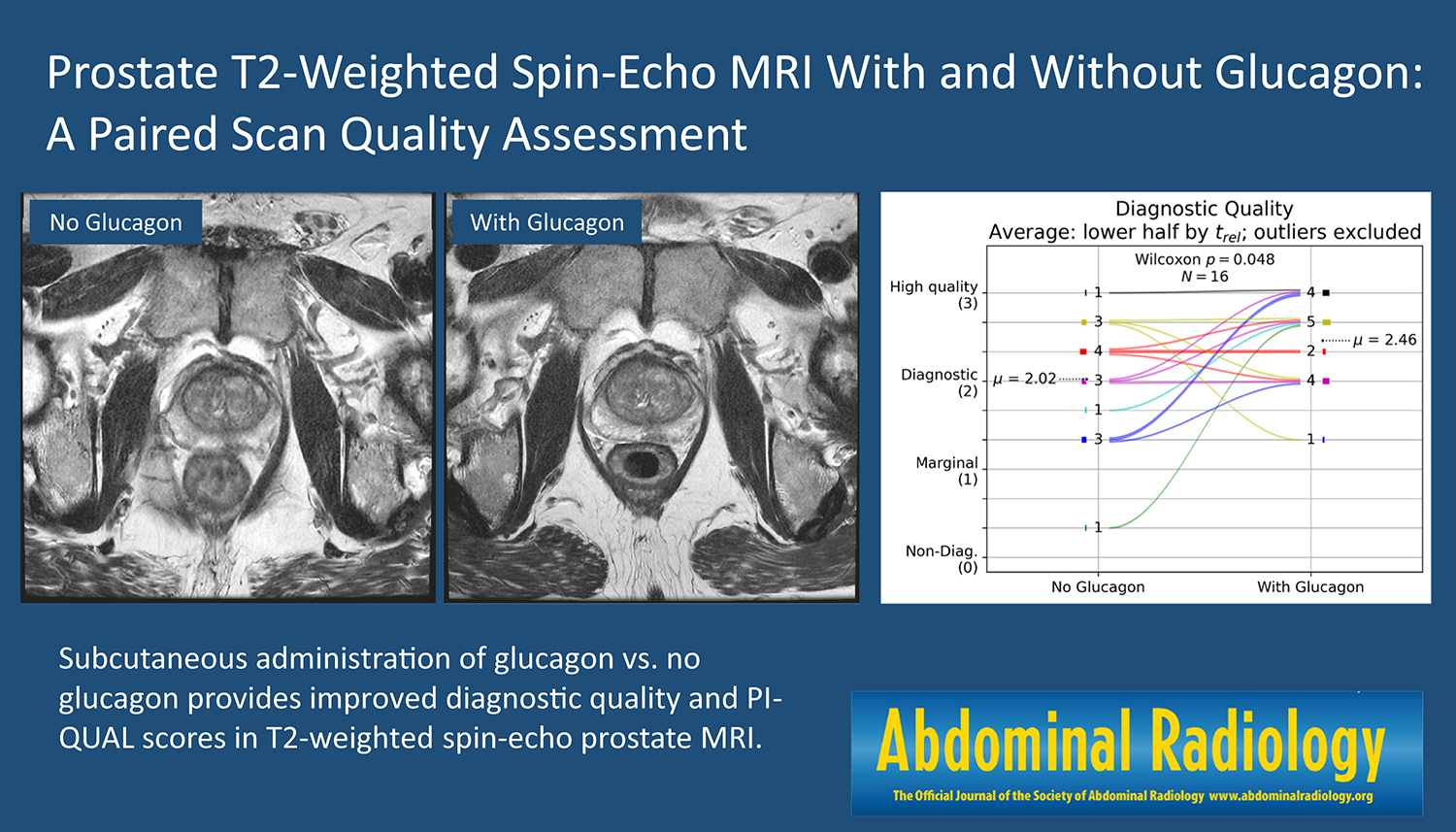 Magnetic Resonance Imaging | Prostate T2-weighted spin-echo MRI with ...