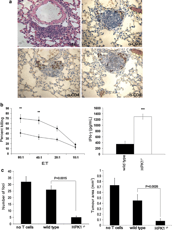 Hematopoietic progenitor kinase 1 is a critical component of ...