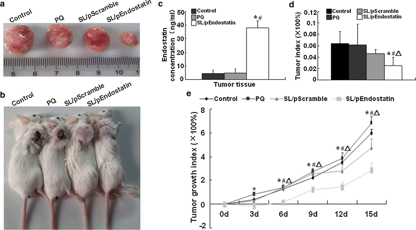 Endostatin inhibits the growth and migration of 4T1 mouse breast cancer ...