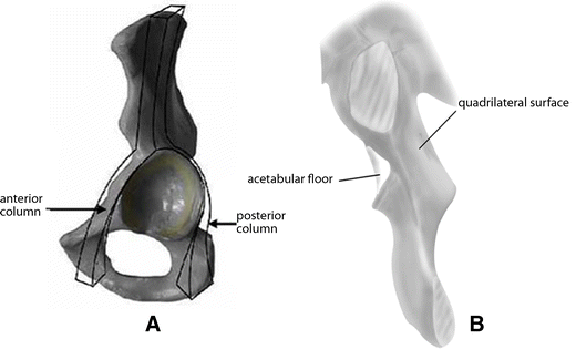 The study of broken quadrilateral surface in fractures of the ...