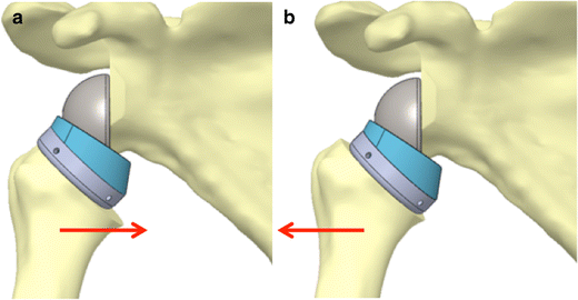 Effect of humeral stem design on humeral position and range of motion ...