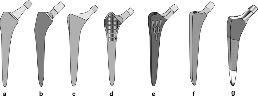 Radiological identification of Zweymüller-type femoral stem prosthesis ...