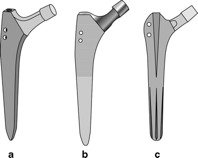 Radiological identification of Zweymüller-type femoral stem prosthesis ...