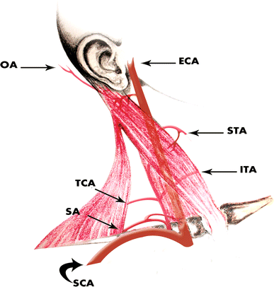 Use of a Sternocleidomastoid Myocutaneous Flap Based on the ...