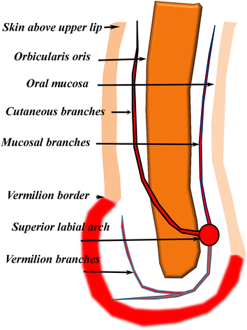 A Typical Pattern of the Labial Arteries with Implication for Lip ...
