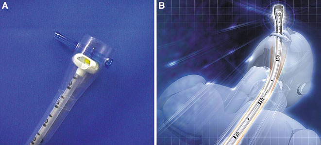 Covering the Percutaneous Endoscopic Gastrostomy (PEG) Tube Prevents ...