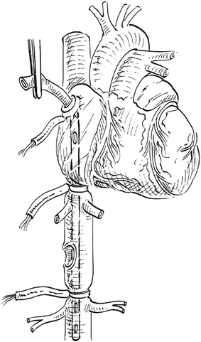 Management of Liver Trauma | SpringerLink
