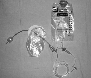 Metabolic and Nutritional Support of the Enterocutaneous Fistula ...